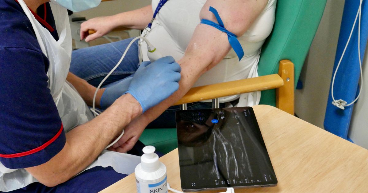 Point of Care device has a big impact in Same Day Emergency Care - NHS ...